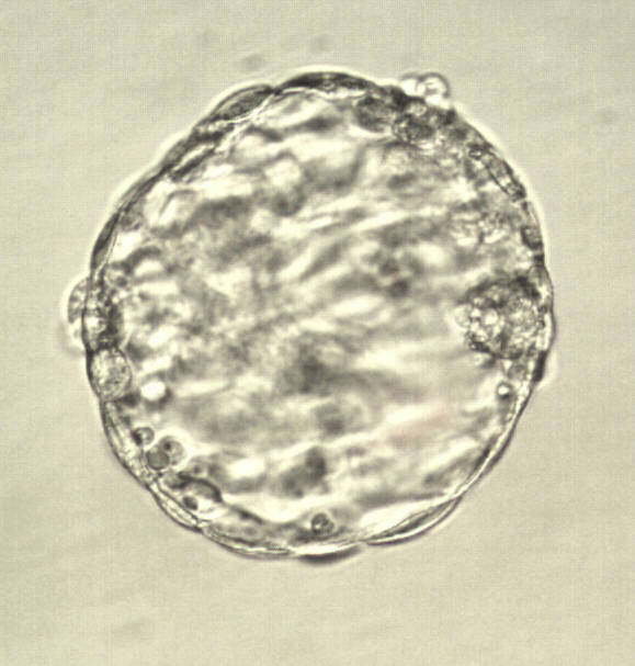 Hatching of the blastocyst - Eugonia